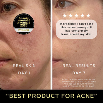 Raven Botanicals: Award-Winning Natural Skincare